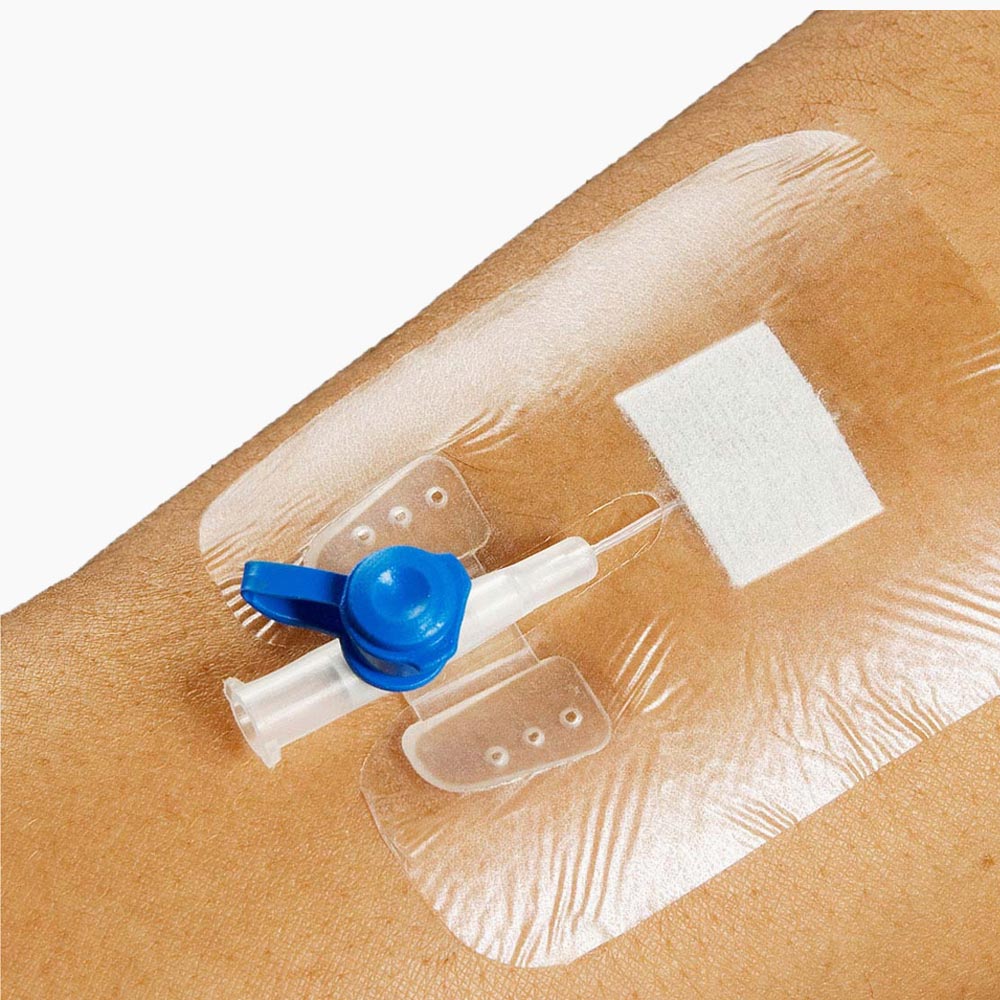 The Ultimate Guide to IV Cannula Fixator: Uses, Benefits, and More
